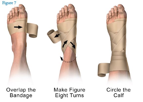 That’s How We Roll: Ankle Injuries in Skydiving
